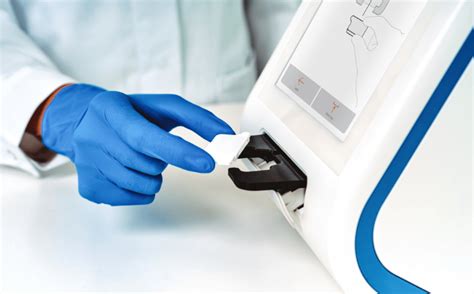 Abionics Test Diagnoses Sepsis 3 Days Before The Standards Methods