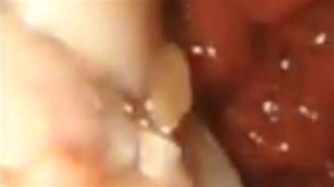 Whole Chicken Digestion Endoscopy 720hd Nicoletta Embassi Clips4sale