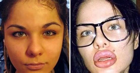 Se Operó 100 Veces Los Labios Para Parecerse A Jessica Rabbit Infobae