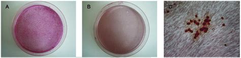 The Effect Of NUCB2 1 83 On Mineralization Measured By Alizarin Red