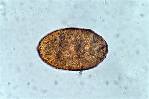 Premium Photo Understanding Preventing And Treating Trichinellosis Infections