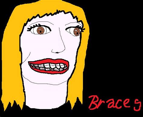 Braces By Artgirlmisti On Deviantart