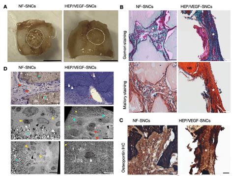 Bone Regeneration In Critical Sized Calvarial Bone Defects Implanted