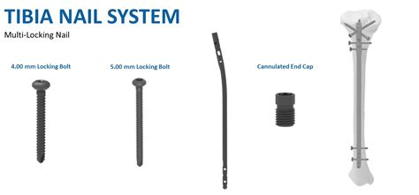 Tibial Tibia Nail System Ml