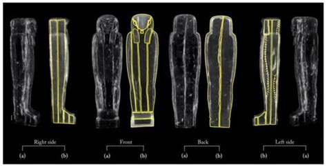 J Imaging Special Issue X Ray Digital Radiography And Computed Tomography