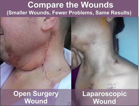 Comprehensive Guide To Neck Dissection Macs Clinic