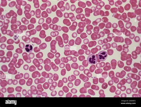 Micrografia Luce Di Cellule Del Sangue Umano Che Mostra Numerosi