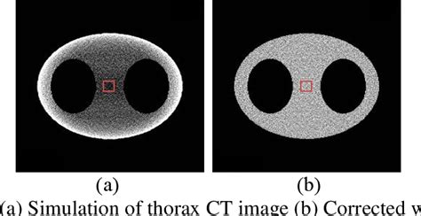 Figure 4 From Computed Tomography Beam Hardening Correction Based On Non Linear Segmentation