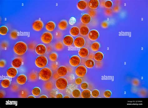 Haematococcus Sp Algae Light Micrograph Stock Photo Alamy