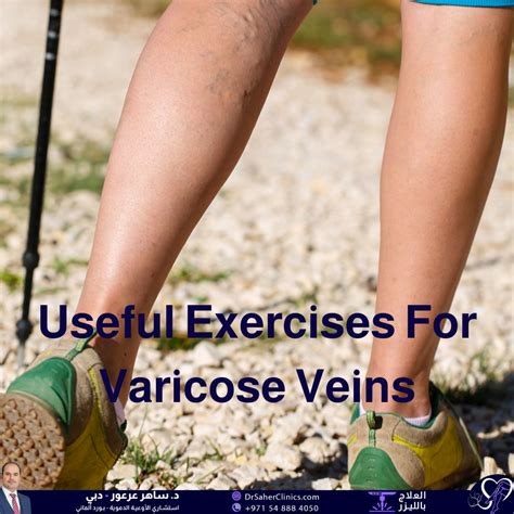 Useful Exercises For Varicose Veins Dr Saher Arour