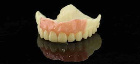 Dentaire365 L Essayage Monobloc Un Atout Pour Vos Protocoles En