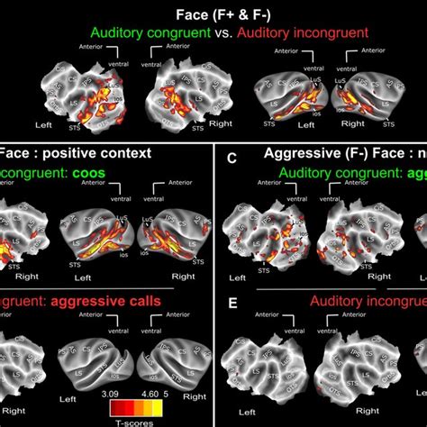 Auditory Activations Depend On Semantic Congruence With Visual Download Scientific Diagram