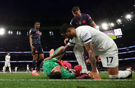 Ederson Will Miss Fa Cup Final With Fractured Eye Socket