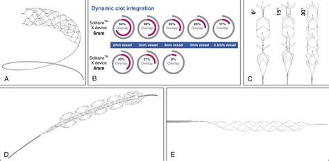 Endovascular Treatment Of Acute Ischemic Stroke Clinical Tree