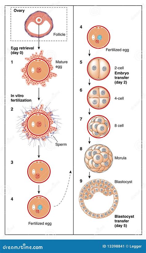 In Vitro Fertilization Cartoon Vector 13398841