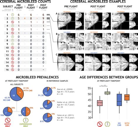 Cerebral Microbleed Counts And Examples In A Sample Of 16 Astronauts