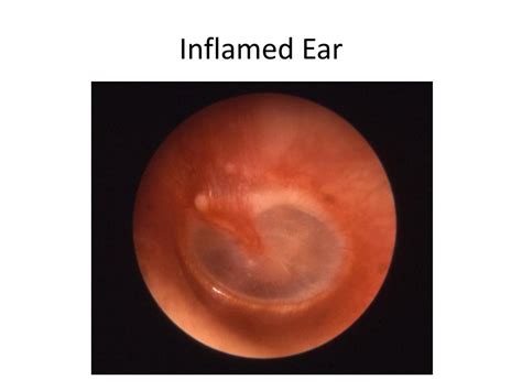 Ppt Physical Examination Neurological Powerpoint Presentation Free