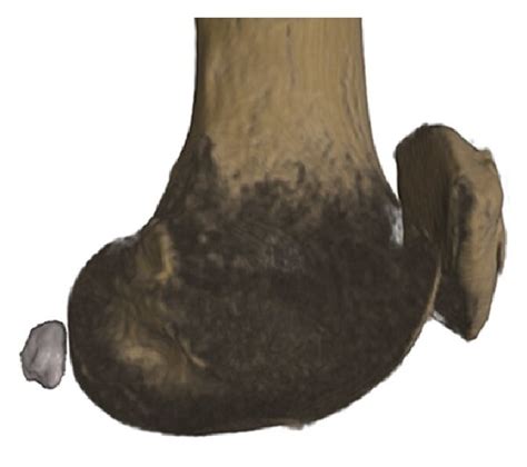 3d Reconstructions For Descriptive Quantitative Analysis A 3d