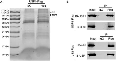 Ubiquitin Specific Protease 1 Acts As An Oncogene And Promotes