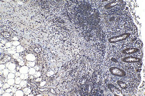 Ihceasy Def6 Ready To Use Ihc Kit Khc1195 Proteintech 武汉三鹰生物技术有限公司