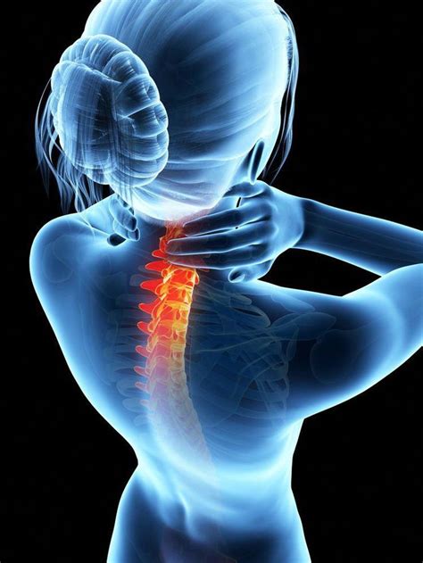 Can Rheumatoid Arthritis Affect The Spine Arthritis Treatment Rheumatoid Arthritis