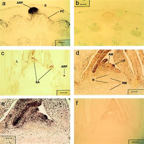 Localization Of Expansin Mrna By In Situ Hybridization In Developing
