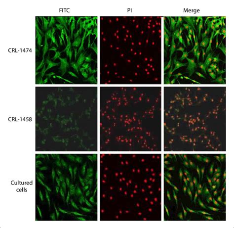 Identification Of Human Dermal Fibroblast Cells By Ddr 2 Staining