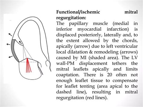 Mitral Valve Anatomypptx