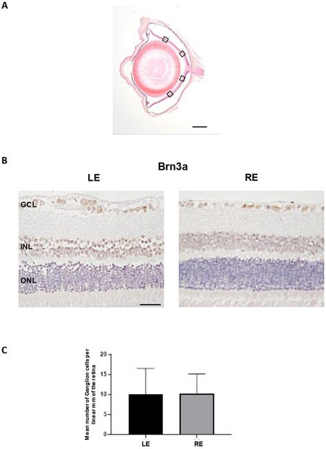 Ganglion Cell Analysis In Glaucomatous Eyes A Ganglion Cells Were