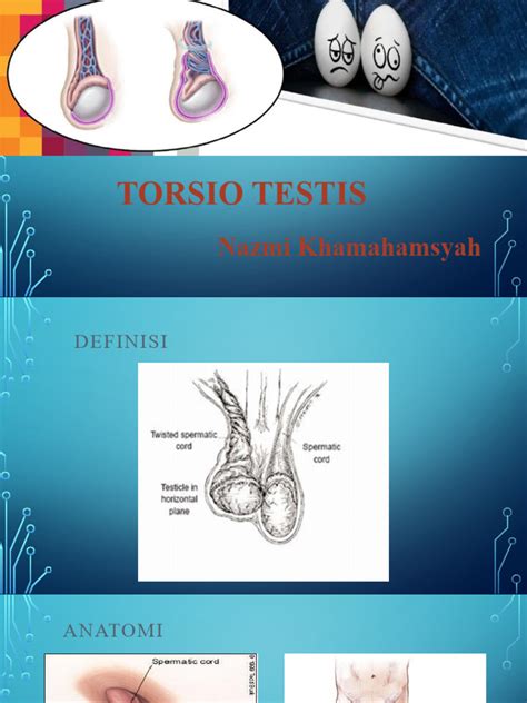 Torsio Testis Dr Nazmi Khamahamsyah 5 Pdf