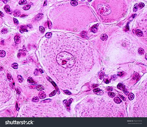 High Magnification Micrograph Pseudounipolar Neuron Dorsal Stock Photo Shutterstock
