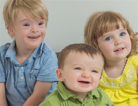 Могут ли люди с синдромом Дауна иметь здоровых детей Генетика и медицина Дзен