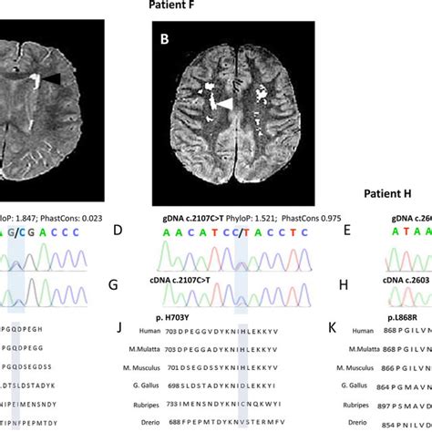 Mri Scans Sanger Sequencing Validation And Mutation Domain