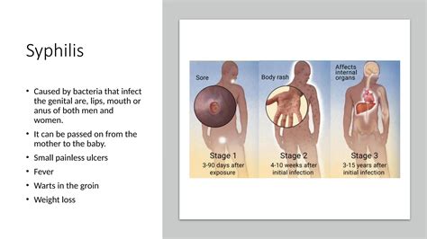 Sexually Transmitted Diseases Lessonpptx