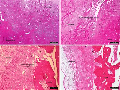 Group 90 Days Showing Bone Tissue Fibrocartilaginous Tissue With