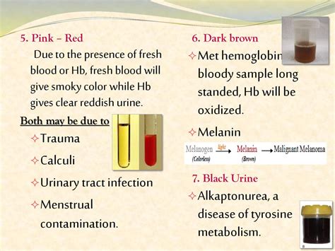 Urinalysis Sample Collection And Physical Examination Ppt Download