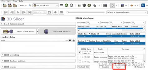 影像组学2：病灶分割 3d Slicer 知乎
