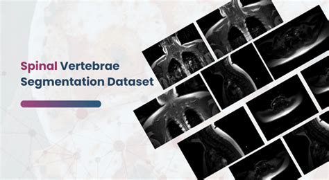 Spinal Vertebrae Segmentation Dataset For Fracture Detection