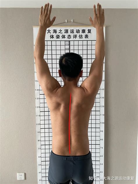 最伤腰的3种睡姿！腰间盘突出到底该怎样睡？ 知乎