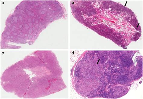hematoxylin and eosin staining of the several distinctive patterns of download scientific