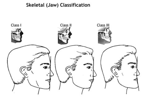 Known Causes Of Malocclusion Ppt