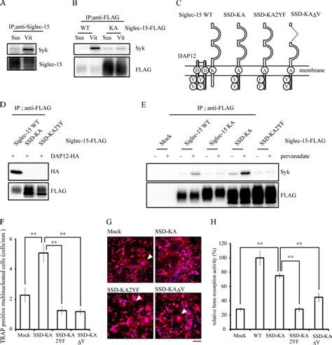 Siglec 15 Is A Dap12 Associated Receptor In Osteoclasts A