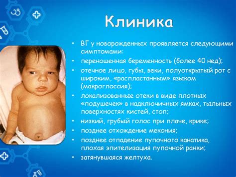 Гипотиреоз у беременных презентация онлайн