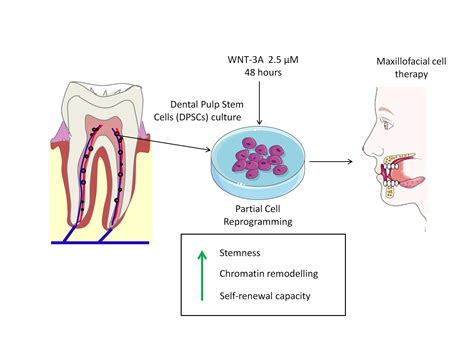 Human Dental Pulp Stem Cells