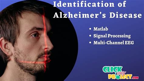 Matlab Signal Processing Project Alzheimers Disease Based On Latent Factor Of Eeg