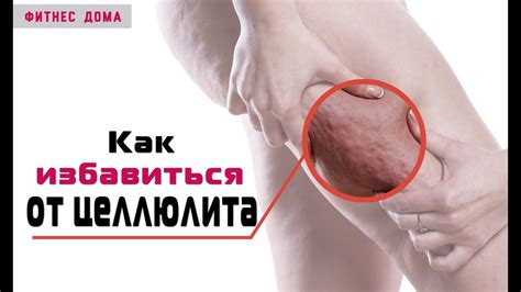 Как ИЗБАВИТЬСЯ от ЦЕЛЛЮЛИТА навсегда Лучшие упражнения и советы как убрать целлюлит Youtube