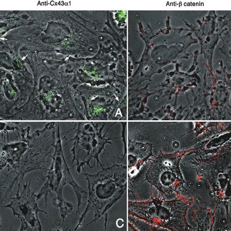 Immunolocalization Of P120ctn In N Cadherin And Cx43 ␣ 1 Deficient Download Scientific Diagram