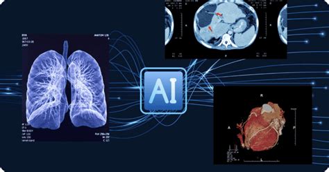 How Artificial Intelligence Works With Medical Imaging