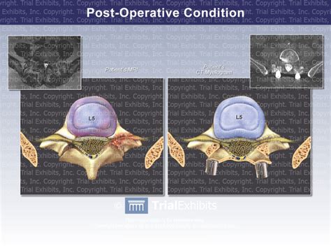 Post Operative Condition Trialquest Inc