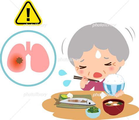 食事中にむせるシニア女性と肺炎のイメージ イラスト素材 4389205 フォトライブラリー Photolibrary